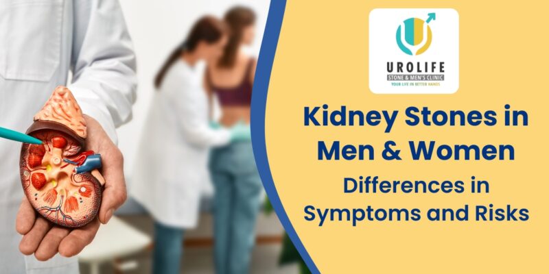 Kidney Stones in Women vs. Men: Differences in Symptoms and Risks - UroLife