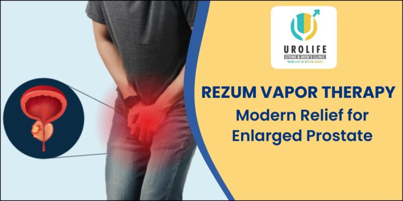 Rezum Vapor Therapy - UroLife